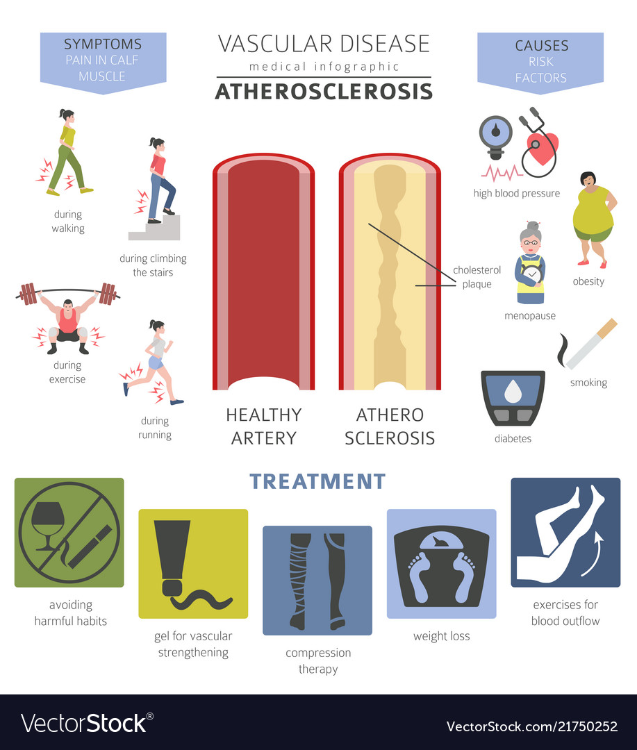 Vascular diseases atherosclerosis symptoms Vector Image Vascular diseases atherosclerosis symptoms Vector Image