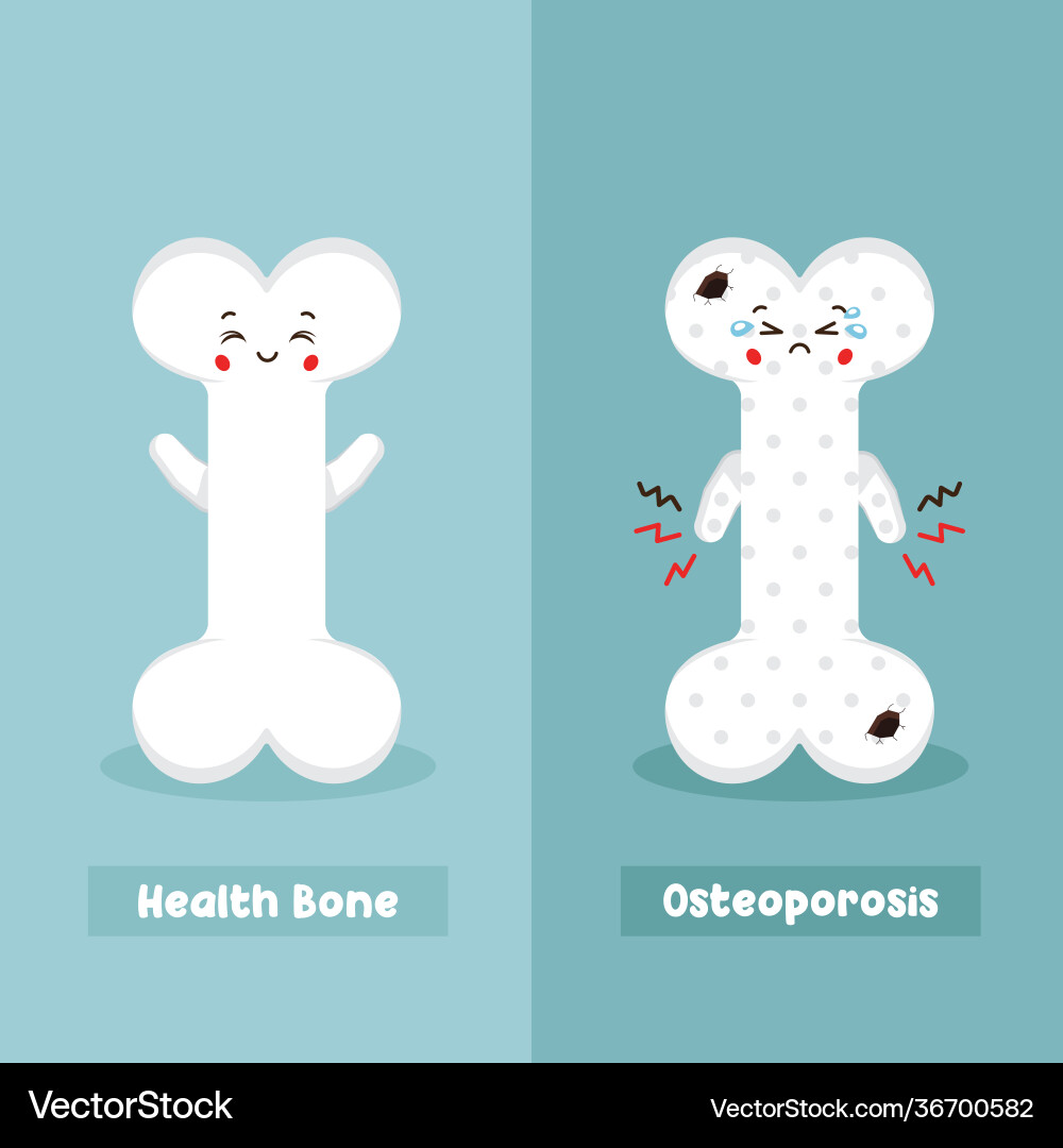Cute healthy bone and osteoporosis Royalty Free Vector Image