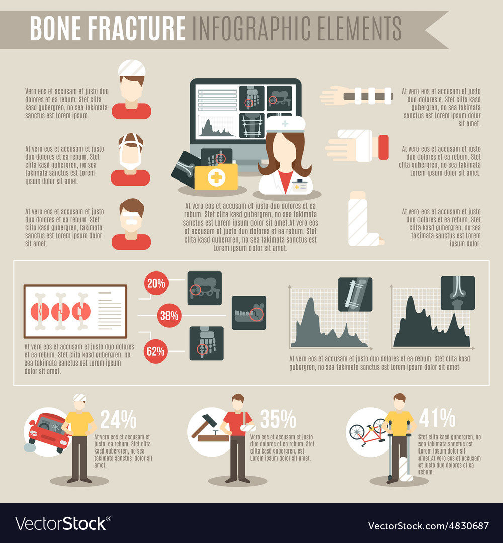 Fracture bone infographics Royalty Free Vector Image