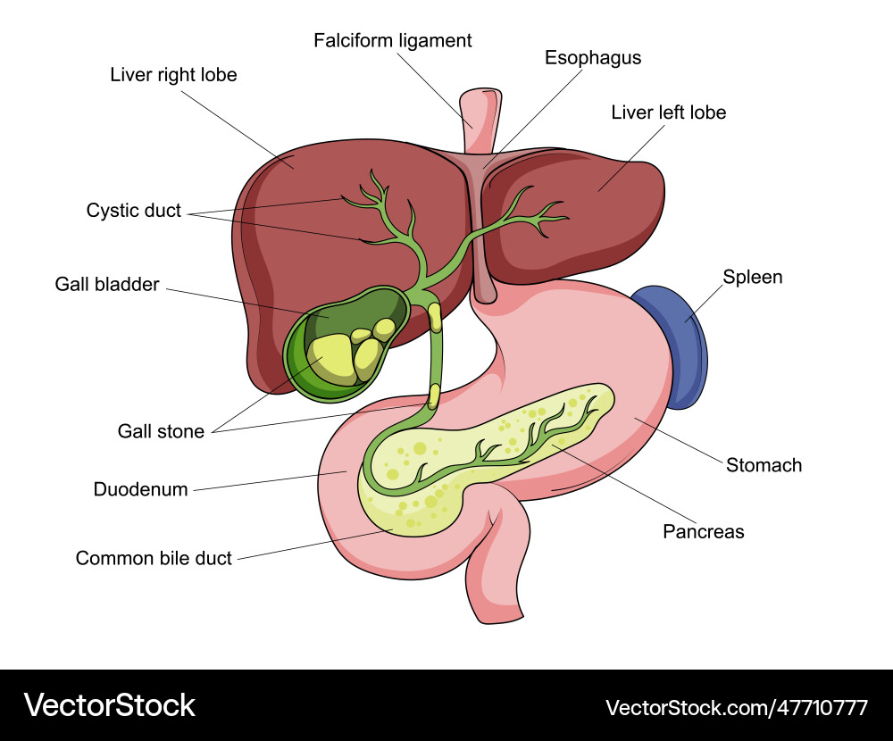 Gallstone stone gallbladder medical science Vector Image