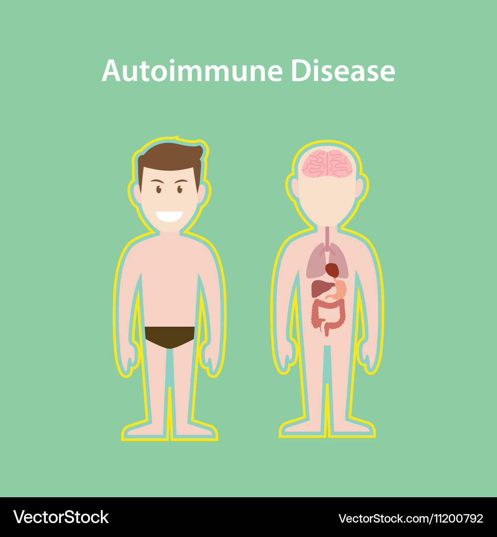 Autoimmune disease system with Royalty Free Vector Image