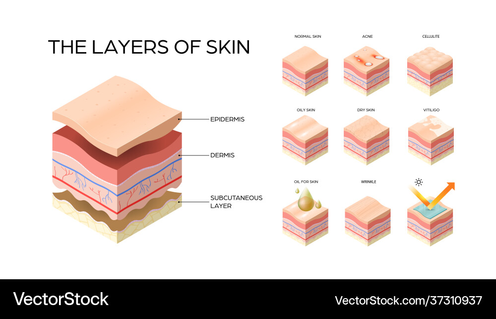 Set different types skin layers cross-section of Vector Image