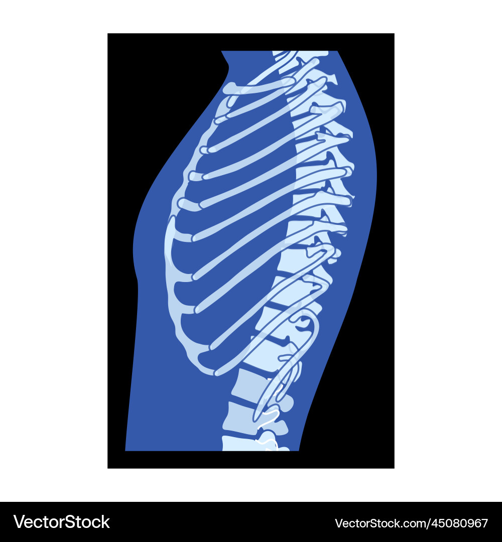 X-ray rib cage skeleton human body - chest Vector Image