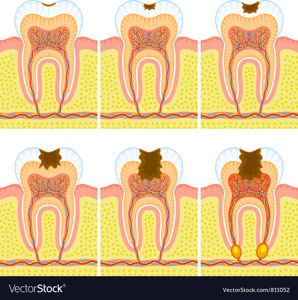 Internal structure tooth Royalty Free Vector Image Internal structure tooth Royalty Free Vector Image