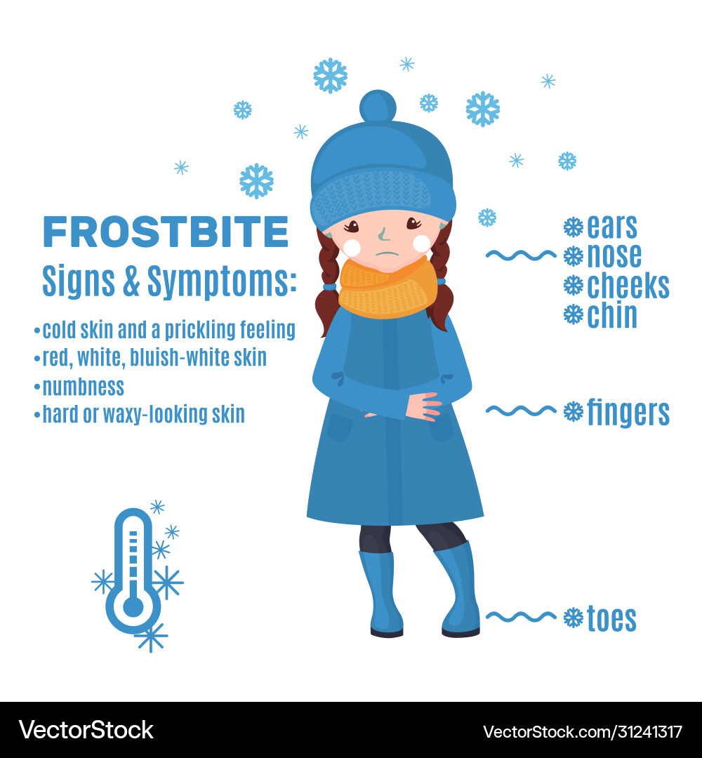 Frostbite infographic in cartoon style isolated Vector Image