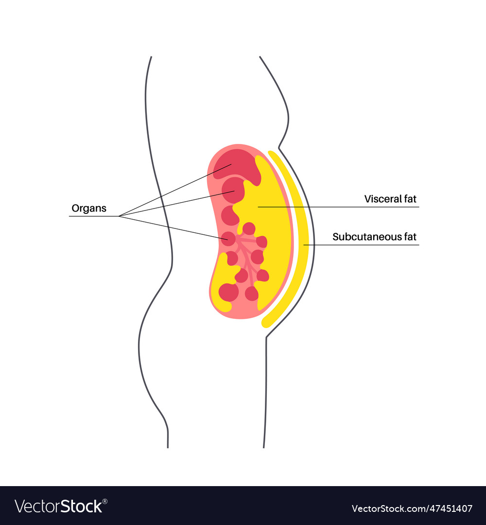 Visceral Fat Diagram Royalty Free Vector Image