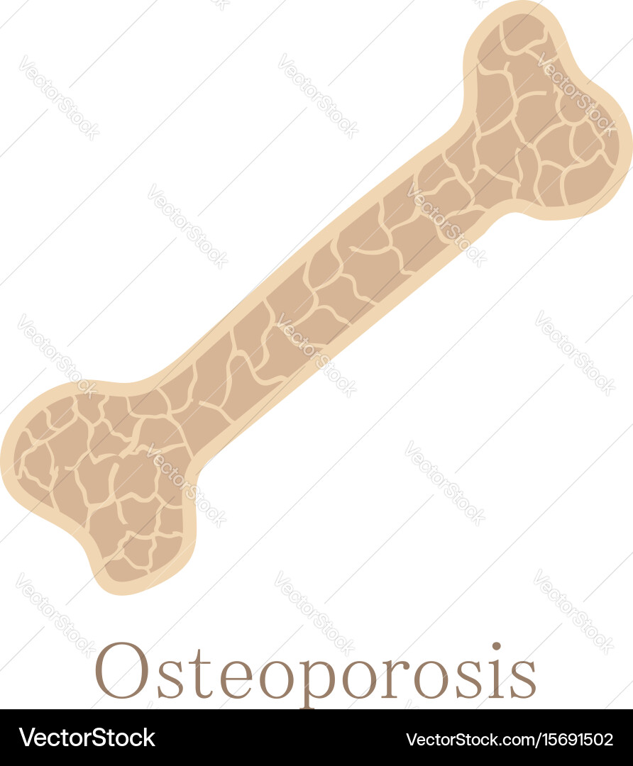 Osteoporosis bone icon cartoon style Royalty Free Vector