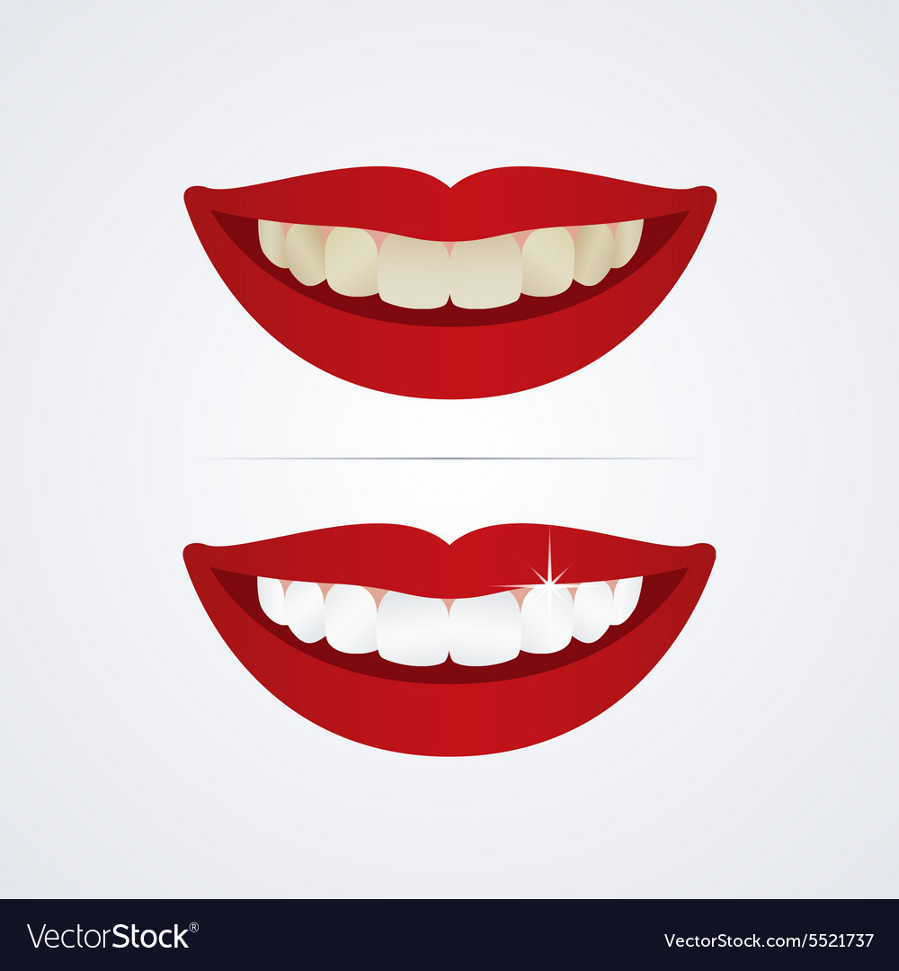 Whitening teeth Royalty Free Vector Image - VectorStock