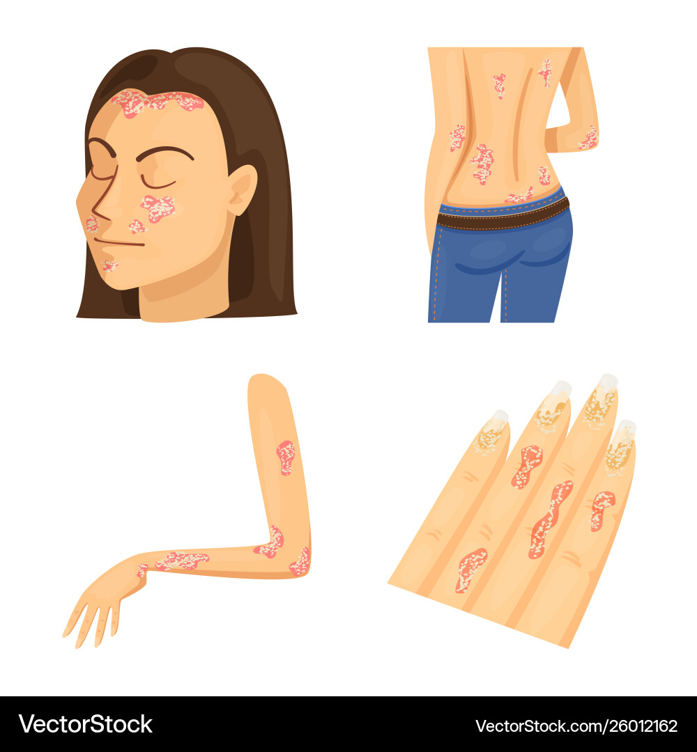 Design pain and dermatology sign set Royalty Free Vector