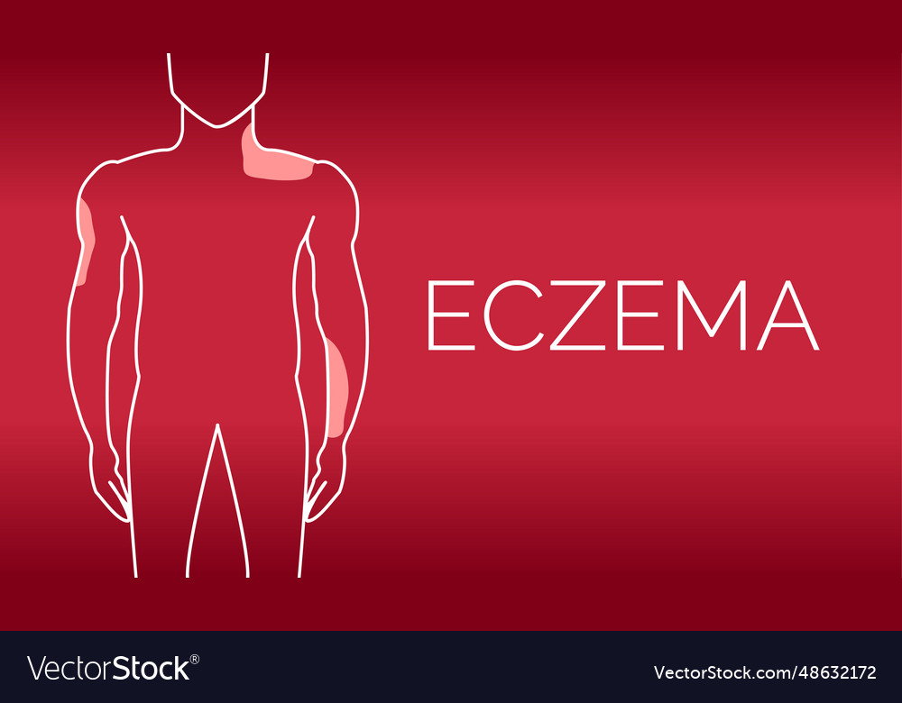 Red eczema background design Royalty Free Vector Image