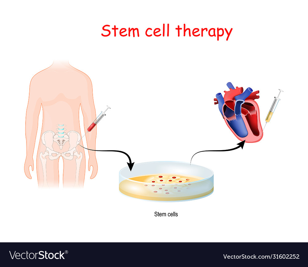 Stem cell therapy Royalty Free Vector Image - VectorStock
