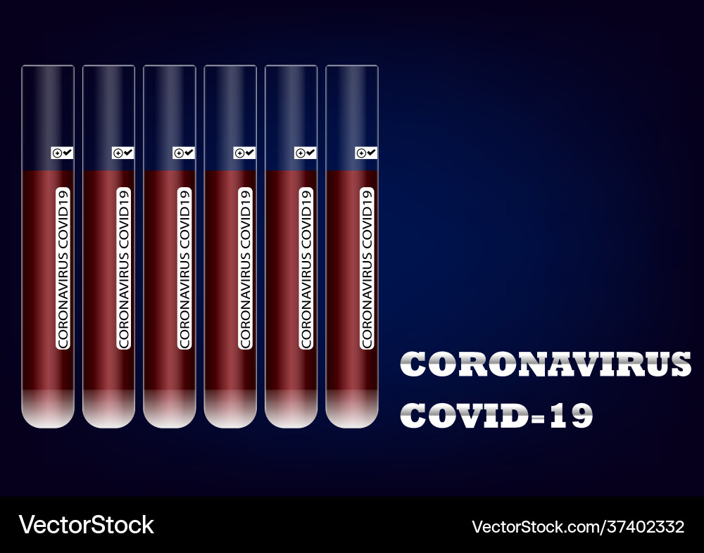 Microbiological blood test results show positive Vector Image