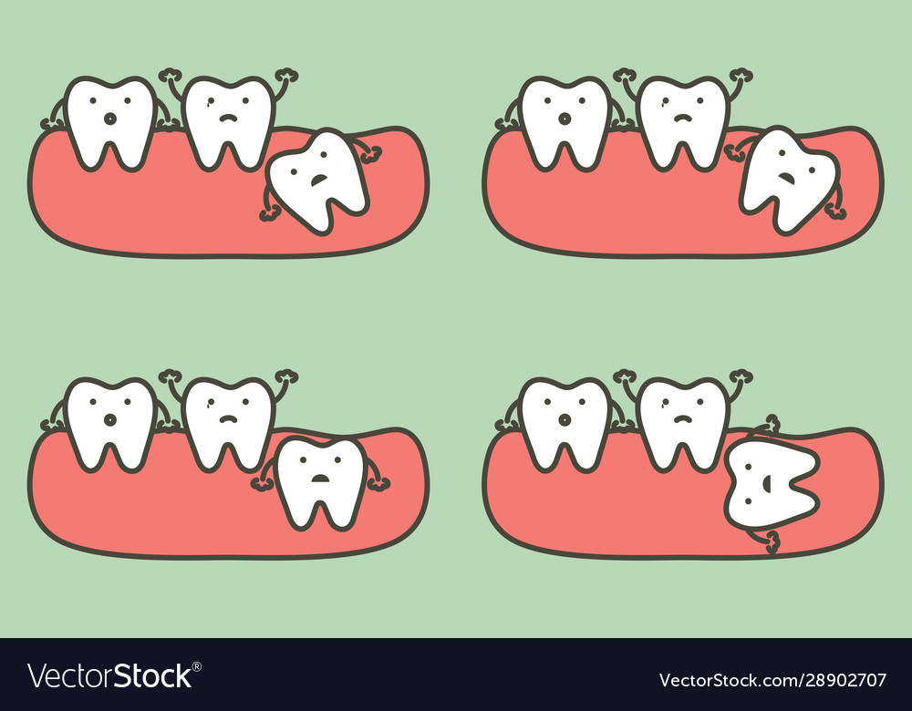 Wisdom tooth type Royalty Free Vector Image - VectorStock