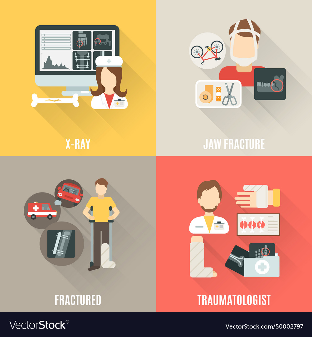 Fracture bone set Royalty Free Vector Image - VectorStock