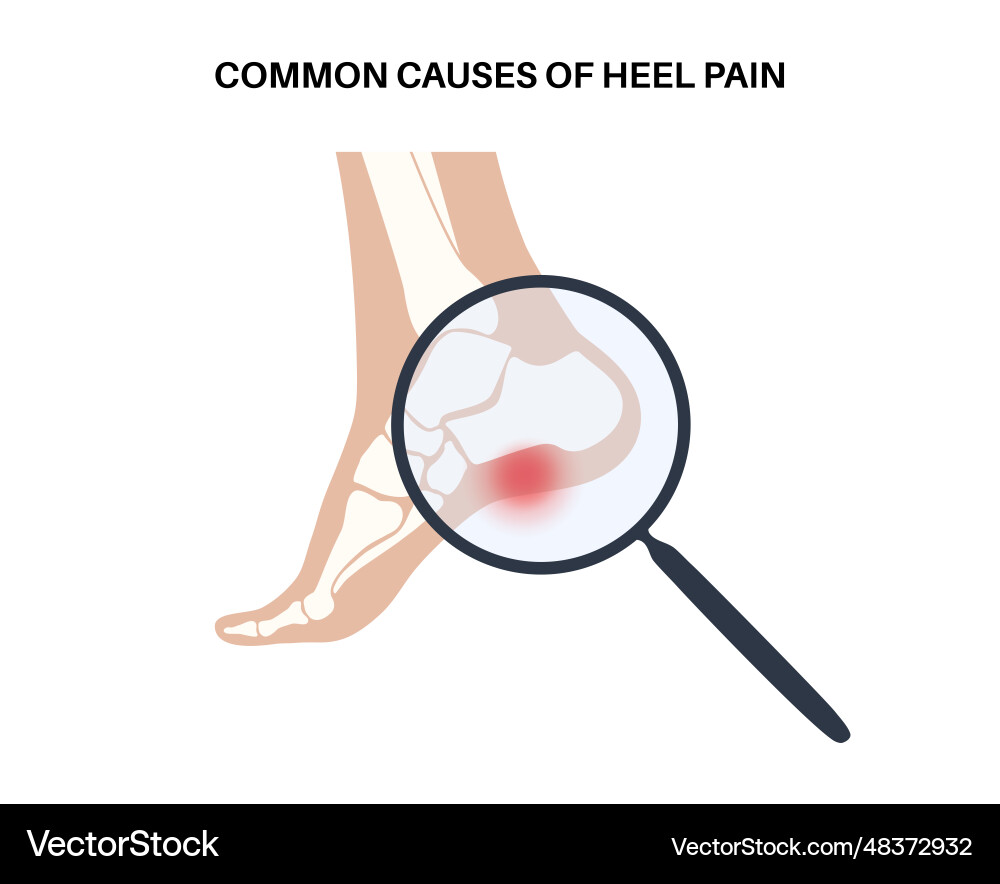 Pain of the heel Royalty Free Vector Image - VectorStock