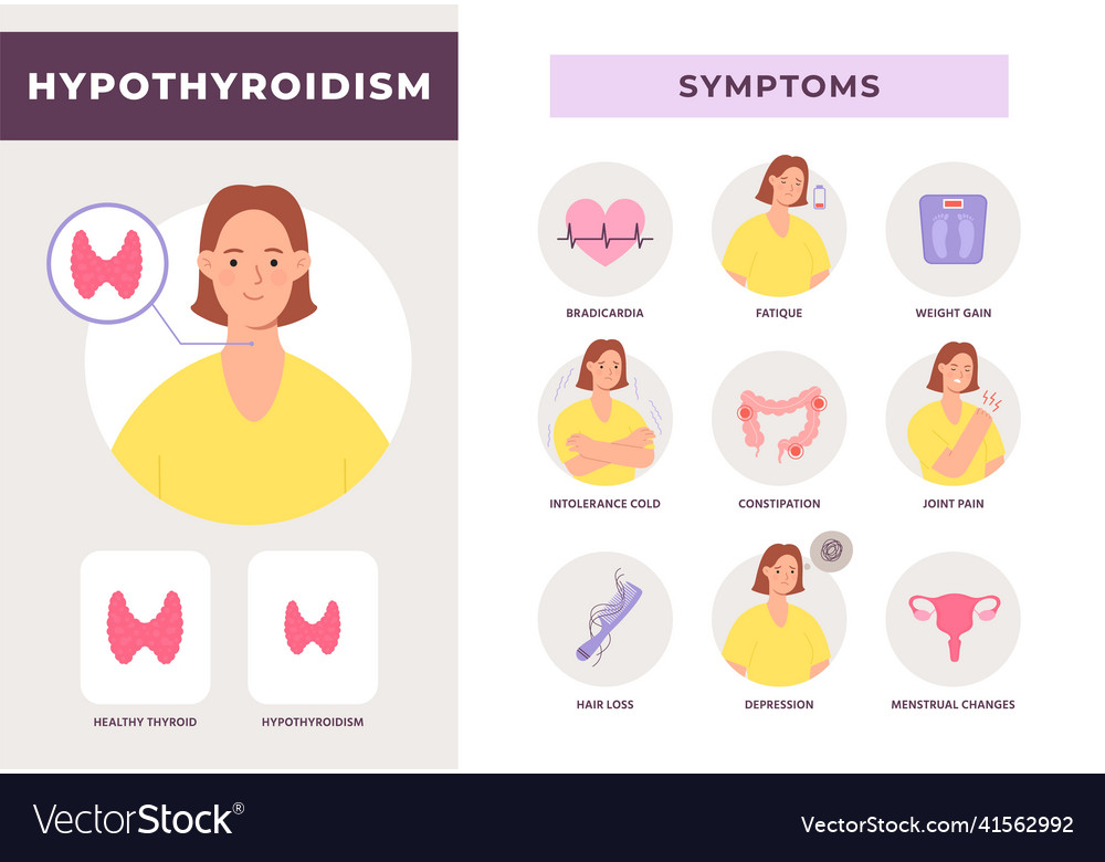 Hypothyroidism Disease Symptoms Infographic Vector Image