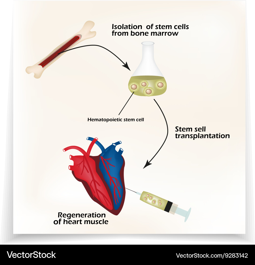 Stem cells from bone marrow is used to regenerate Vector Image