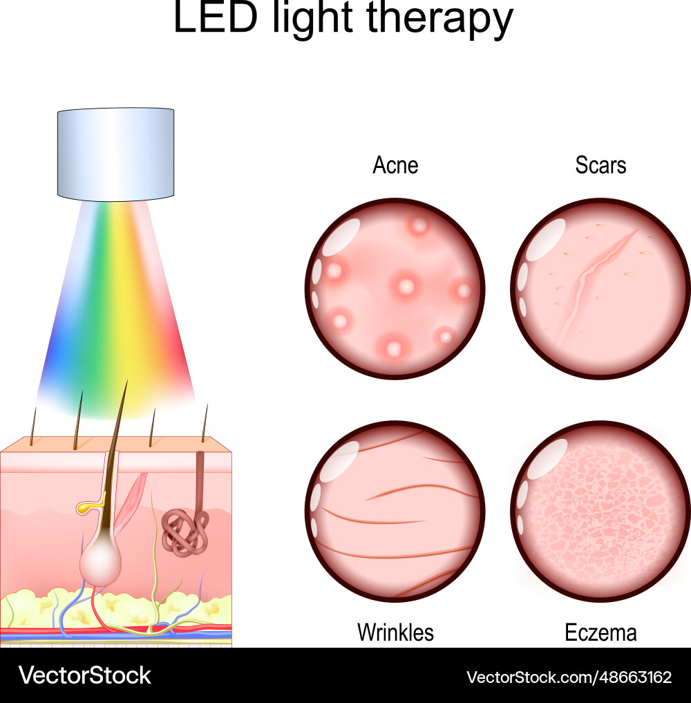 Led light therapy for acne treatment scars Vector Image
