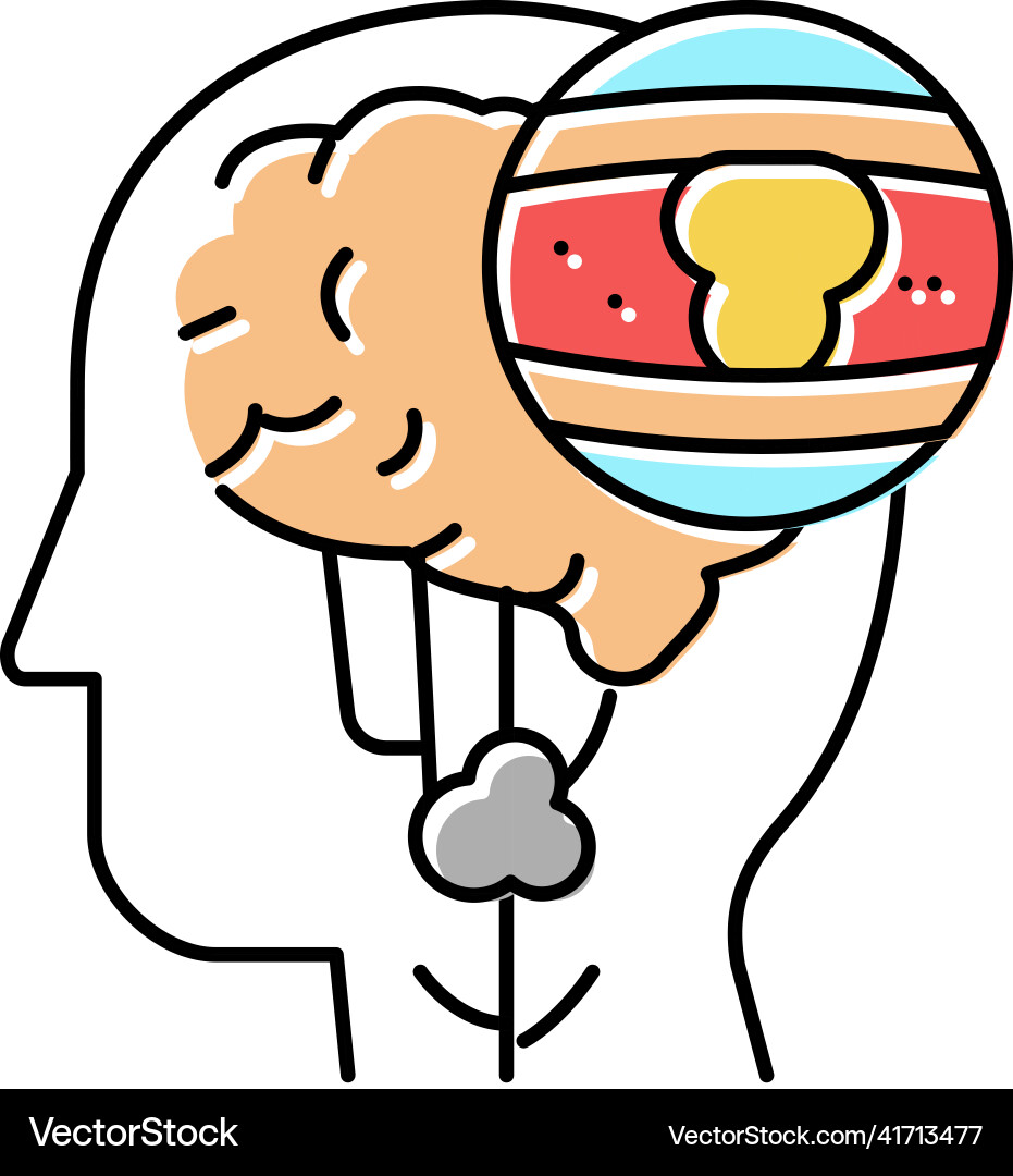 Vessel congestion health problem color icon Vector Image