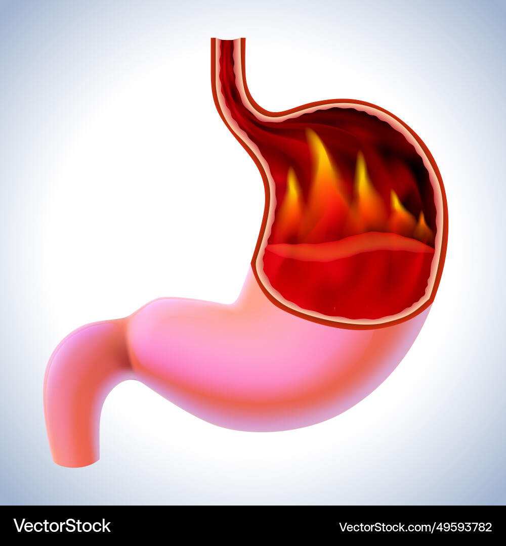 3d of a stomach with flames burning inside Vector Image