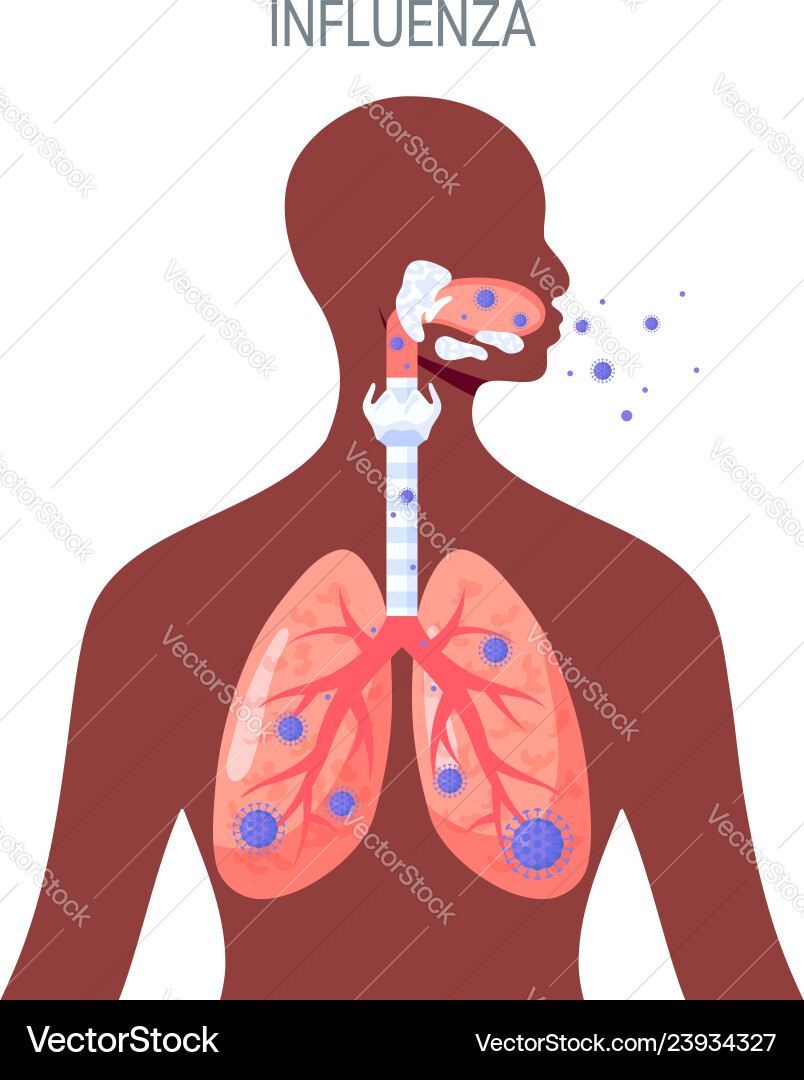 Influenza disease icon in flat style Royalty Free Vector