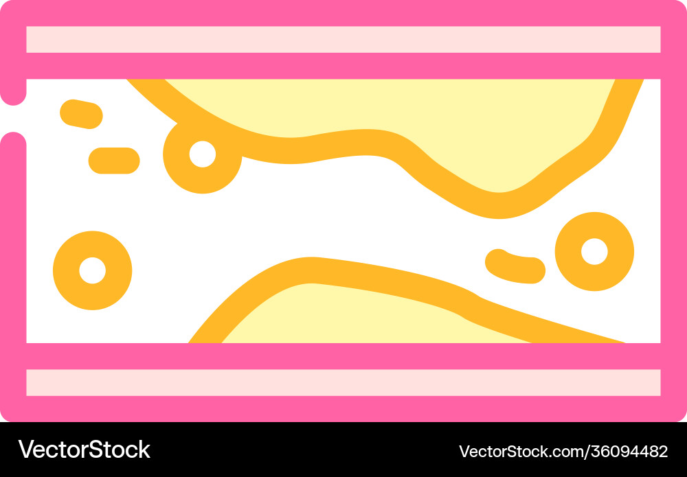 Formation cholesterol plaques in artery color Vector Image