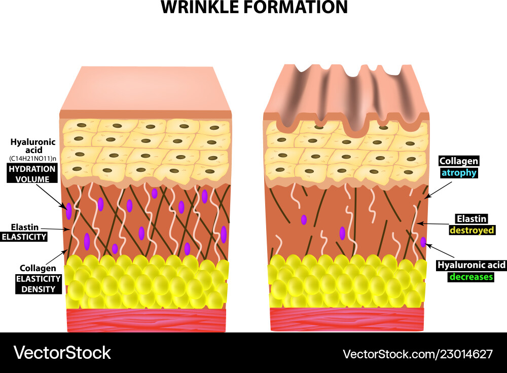 Appearance of wrinkles anatomical structure Vector Image