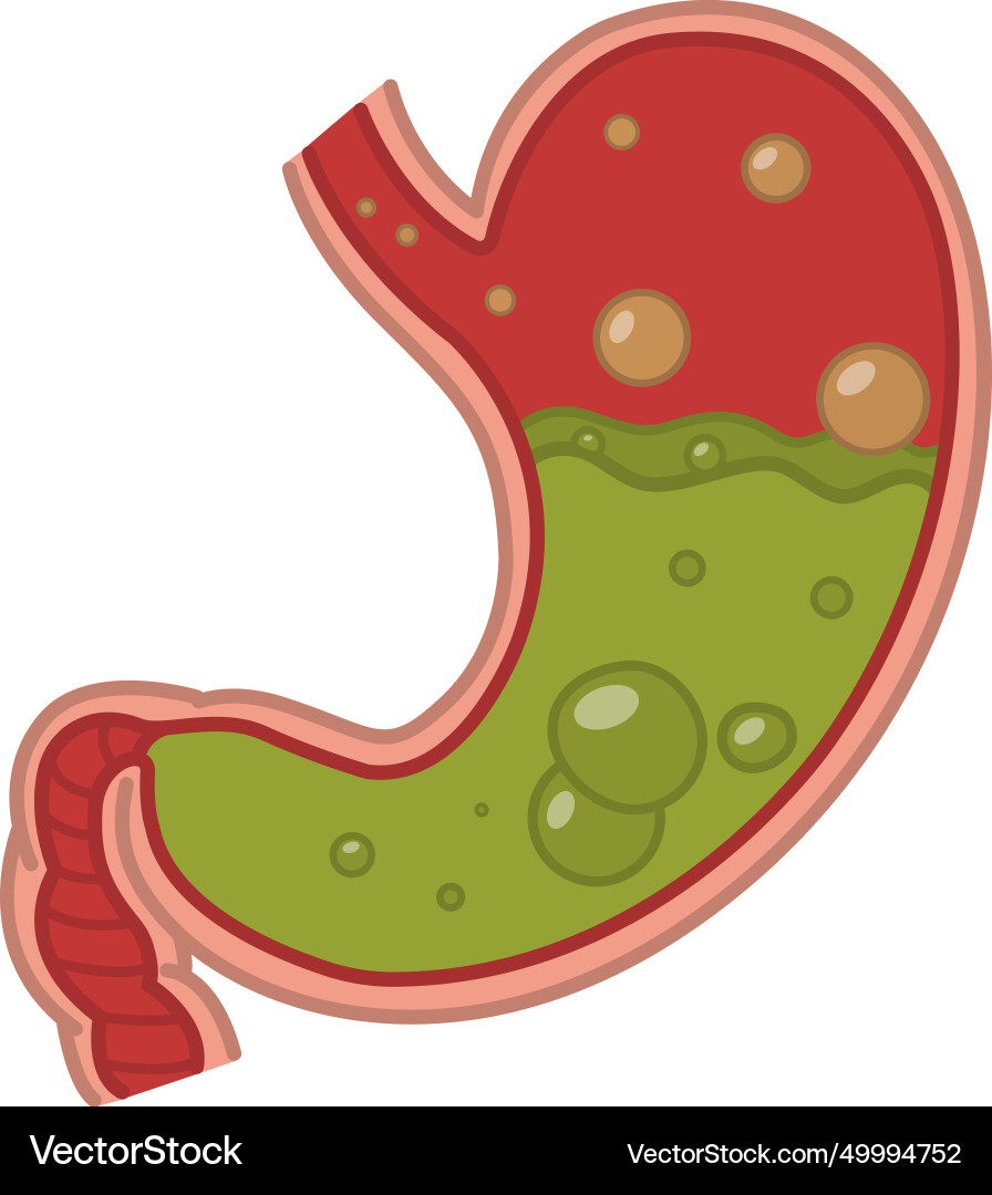 Stomach disease the human is full Royalty Free Vector Image