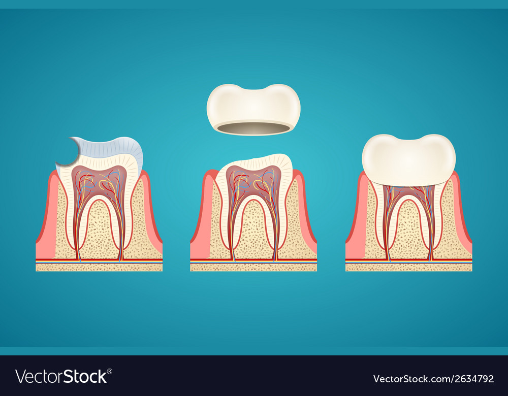 Breaking teeth Royalty Free Vector Image - VectorStock