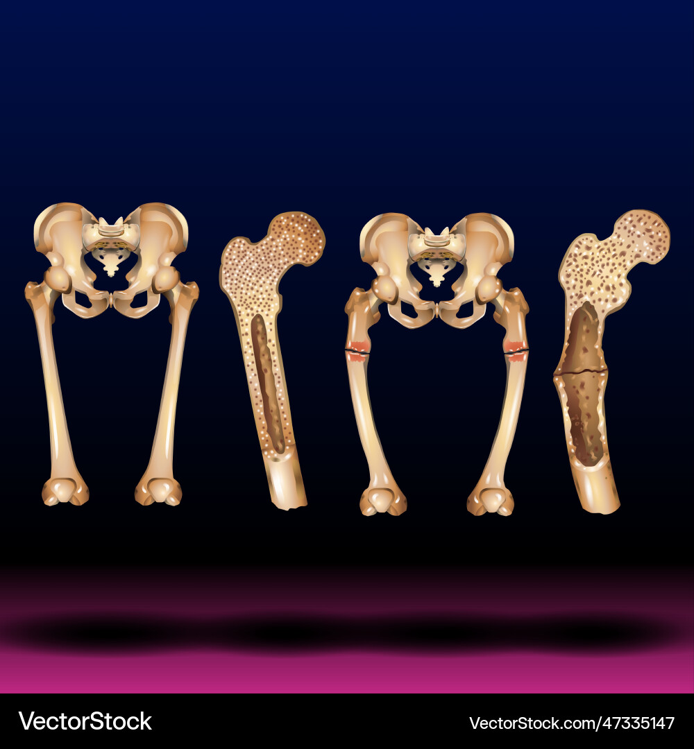Structure of the pelvis Royalty Free Vector Image