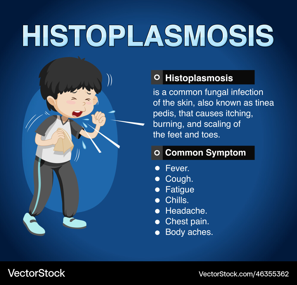 Informative poster of histoplasmosis Royalty Free Vector