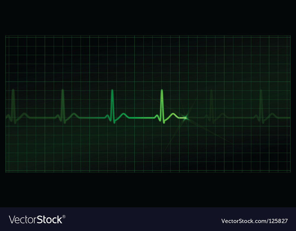 Cardiogram Royalty Free Vector Image - VectorStock