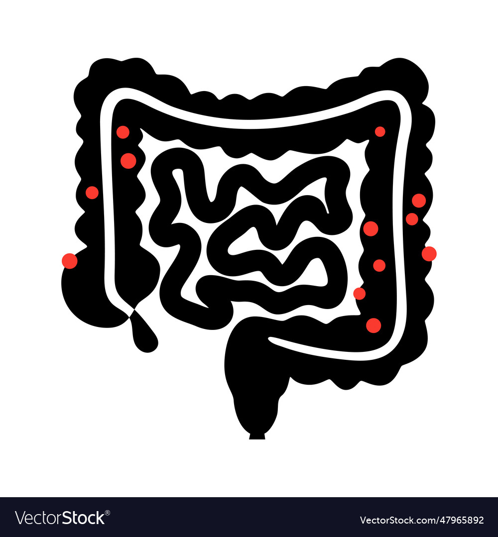 Diverticulitis And Diverticulosis Royalty Free Vector Image