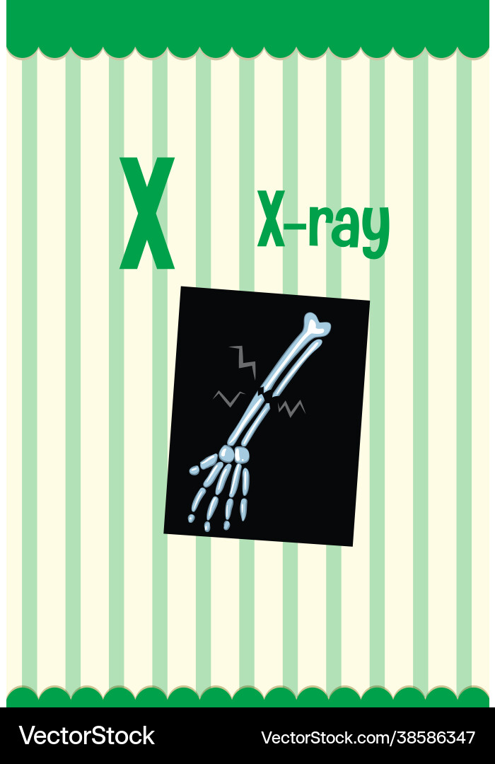 Alphabet flashcard with letter x for x-ray Vector Image
