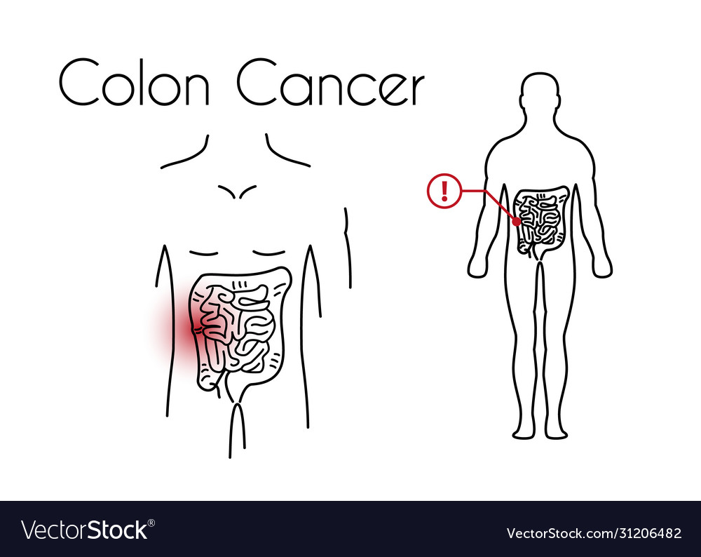Colon Cancer Linear Icon Young Man Royalty Free Vector Image