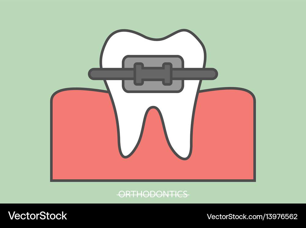 Orthodontics teeth or dental braces Royalty Free Vector