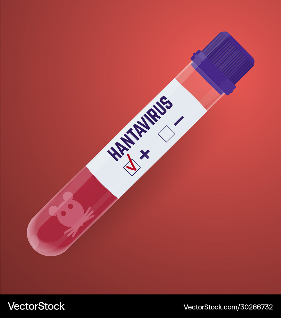 Hantavirus express test vacuum tube Royalty Free Vector