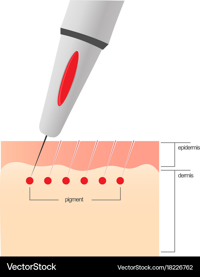 Scheme of the procedure permanent makeup Vector Image