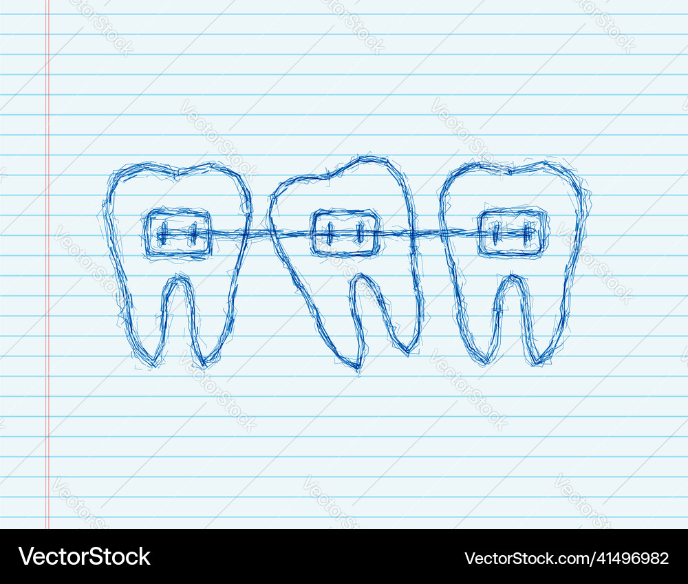 Correction of teeth with orthodontic braces Vector Image