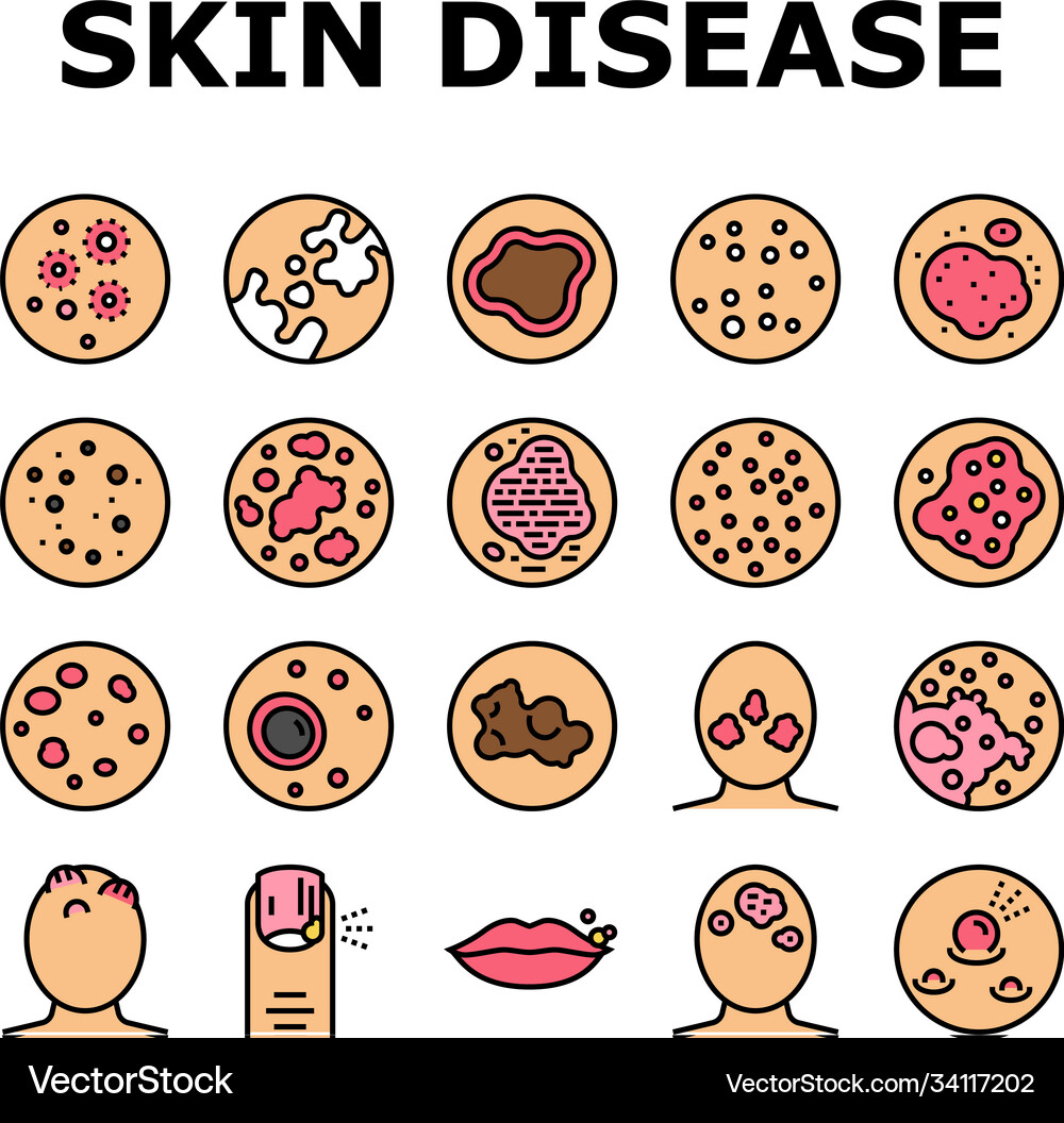 Skin disease symptom collection icons set Vector Image
