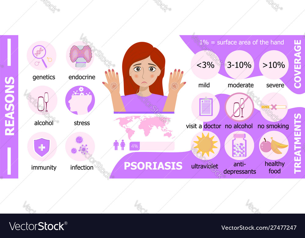 Psoriasis Infographics Reasons And Treatments Vector Image