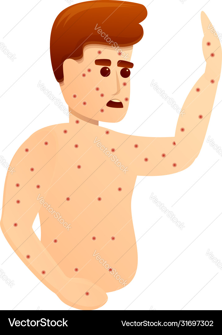 Chicken pox body icon cartoon style Royalty Free Vector