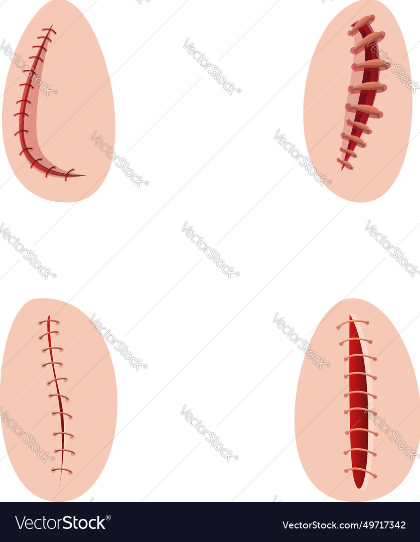 Operating suture icons set cartoon various Vector Image Operating suture icons set cartoon various Vector Image