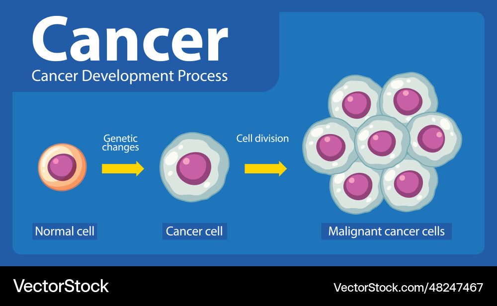 Processing of cancer cells an infographic Vector Image