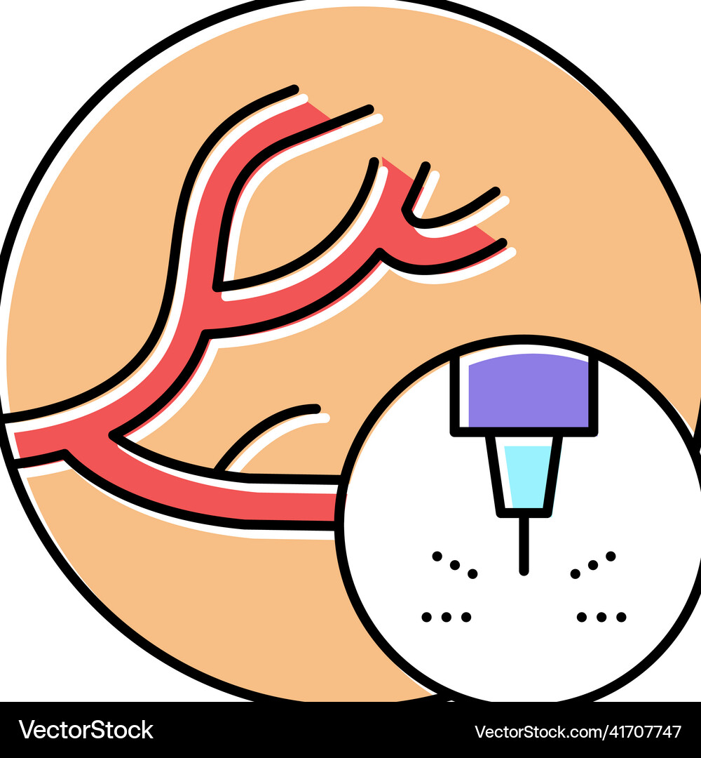 Removal of vascular pathologies color icon Vector Image