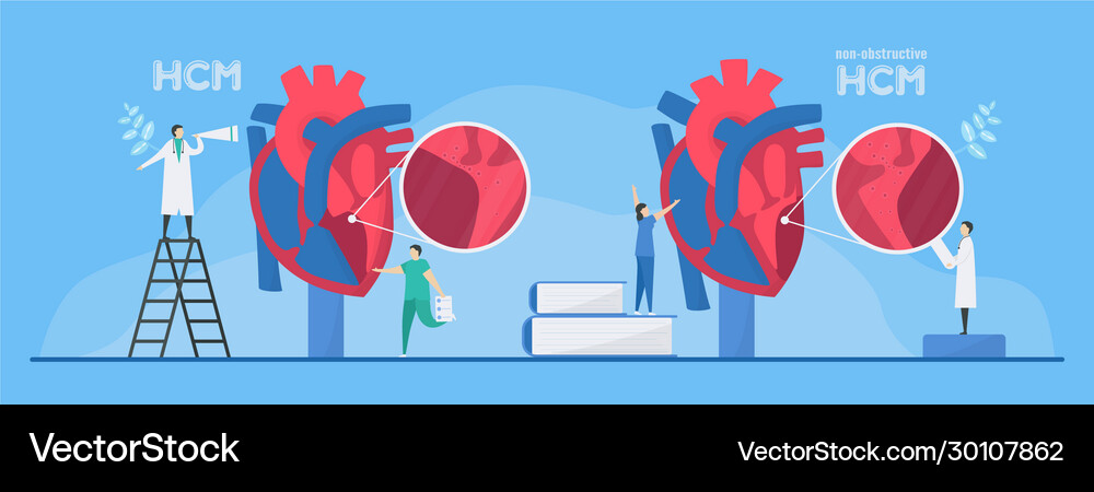 Cardiology this diseases are hcm Royalty Free Vector Image