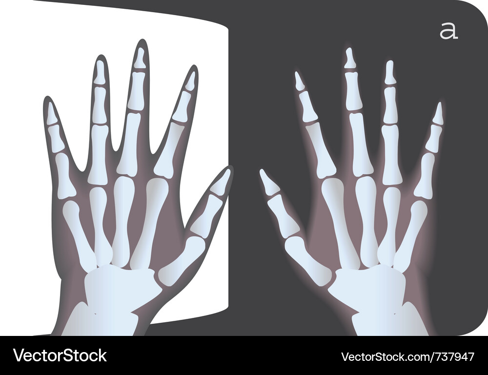 X-ray image of human hands Royalty Free Vector Image
