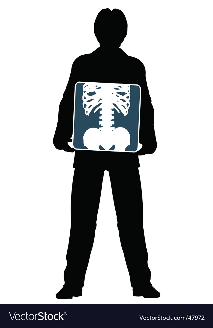 X-ray Royalty Free Vector Image - VectorStock
