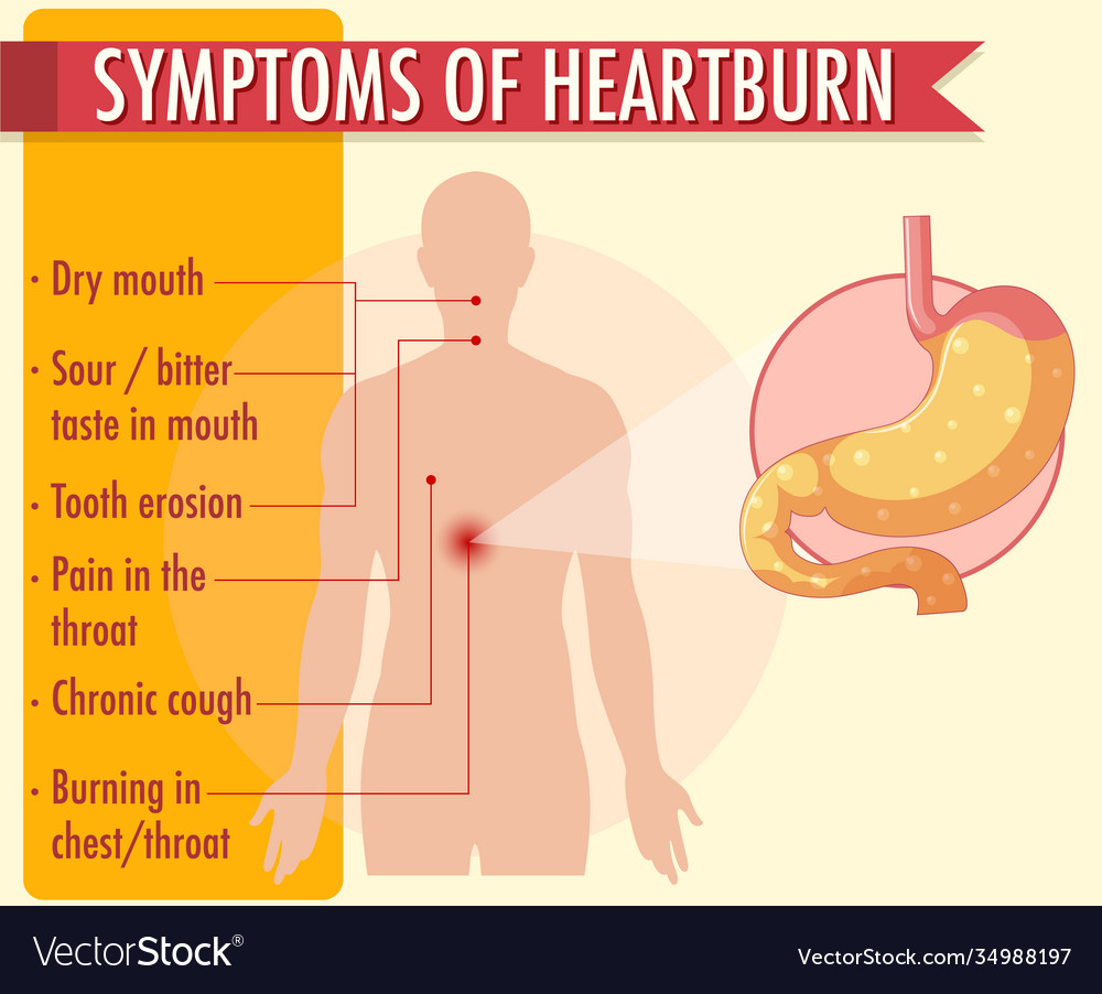Symptoms Heartburn Information Infographic Vector Image