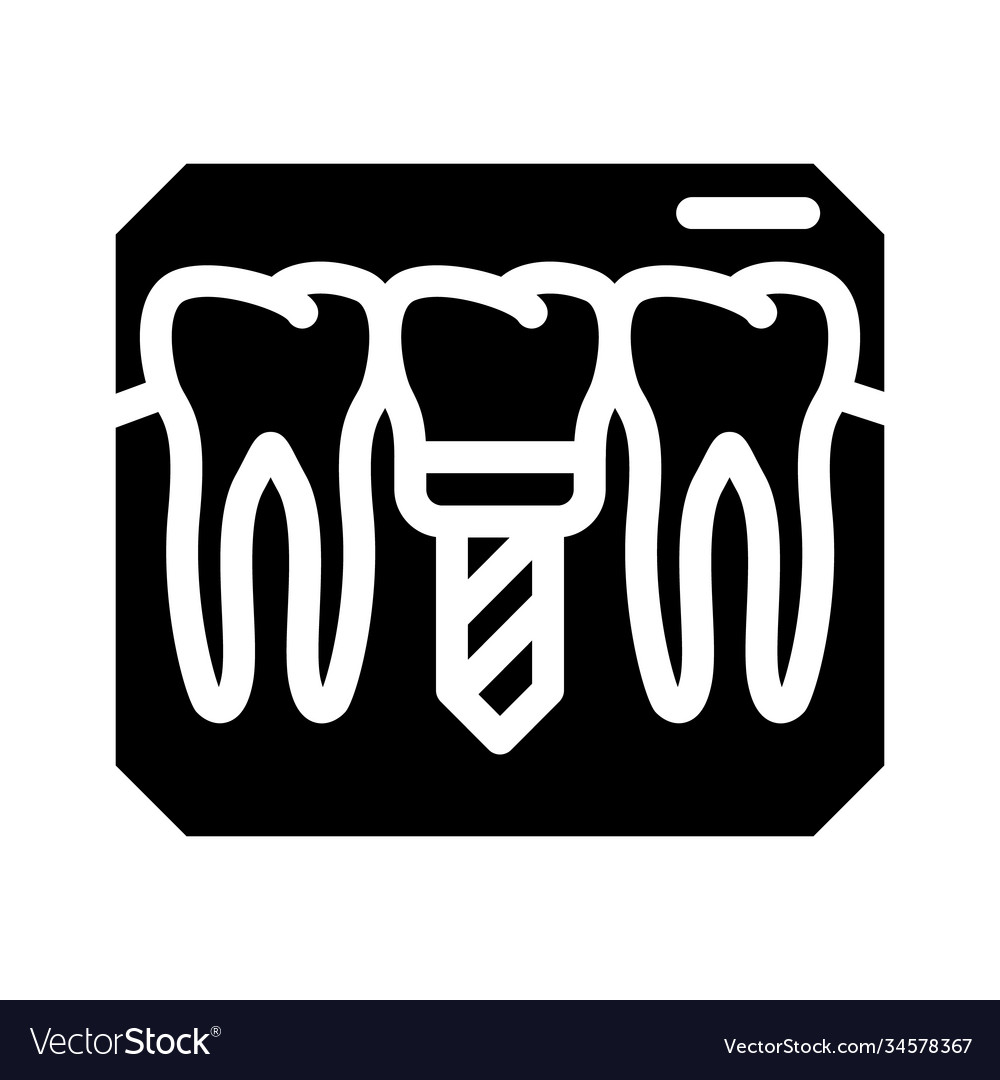 Implant check glyph icon sign Royalty Free Vector Image Implant check glyph icon sign Royalty Free Vector Image